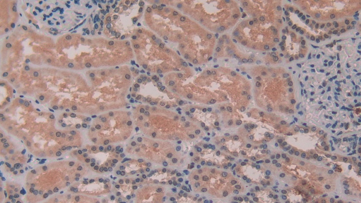 PAA224Hu01 | 基质金属蛋白酶11(MMP11)多克隆抗体 | Homo sapiens (Human，人) USCN(武汉优尔生 ...