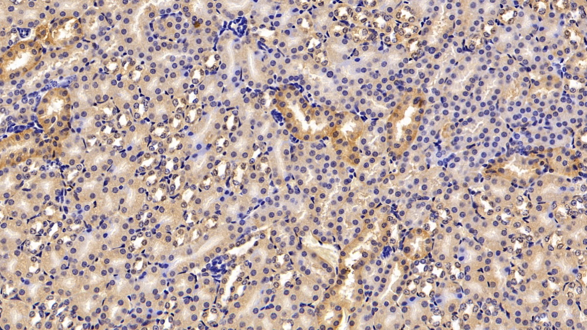 PAB215Hu02 | 纤维蛋白原β(FGB)多克隆抗体 | Homo sapiens (Human，人) USCN(武汉优尔生商贸有限公司)